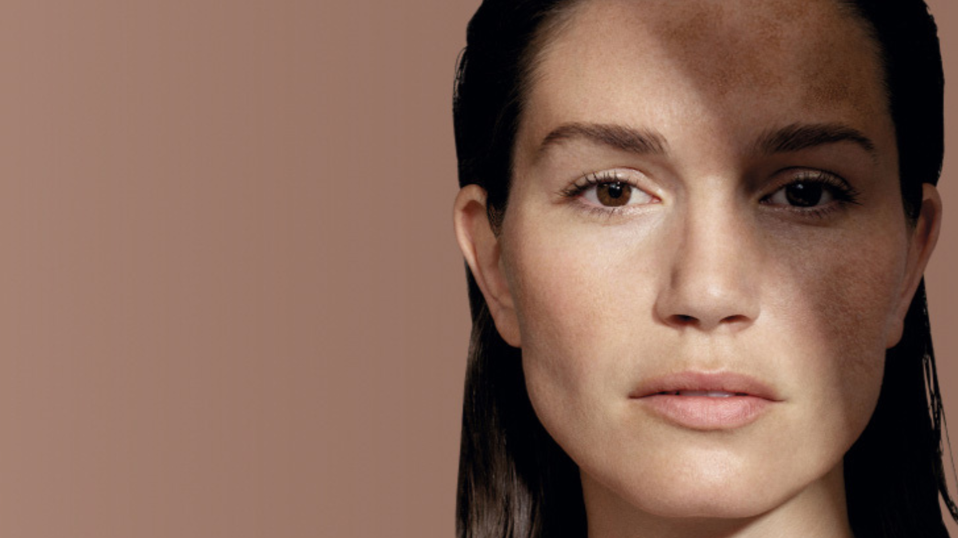 Cosmelan Depigmentation Peel Manchester - The Skin Quartz